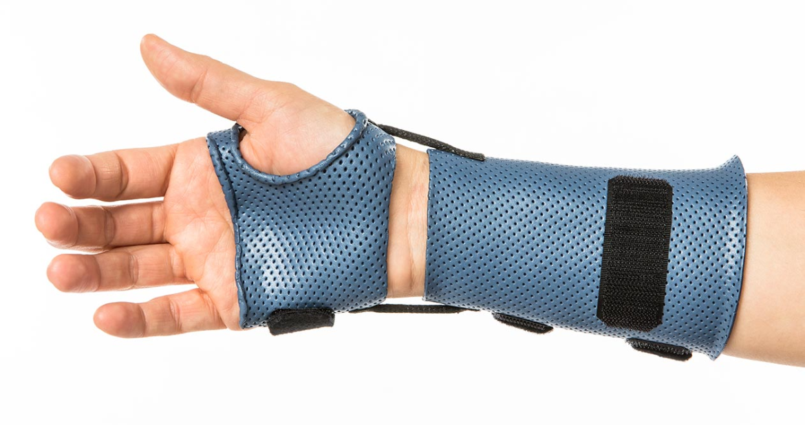 3D Printing Revolutionizing Orthotics Manufacturing